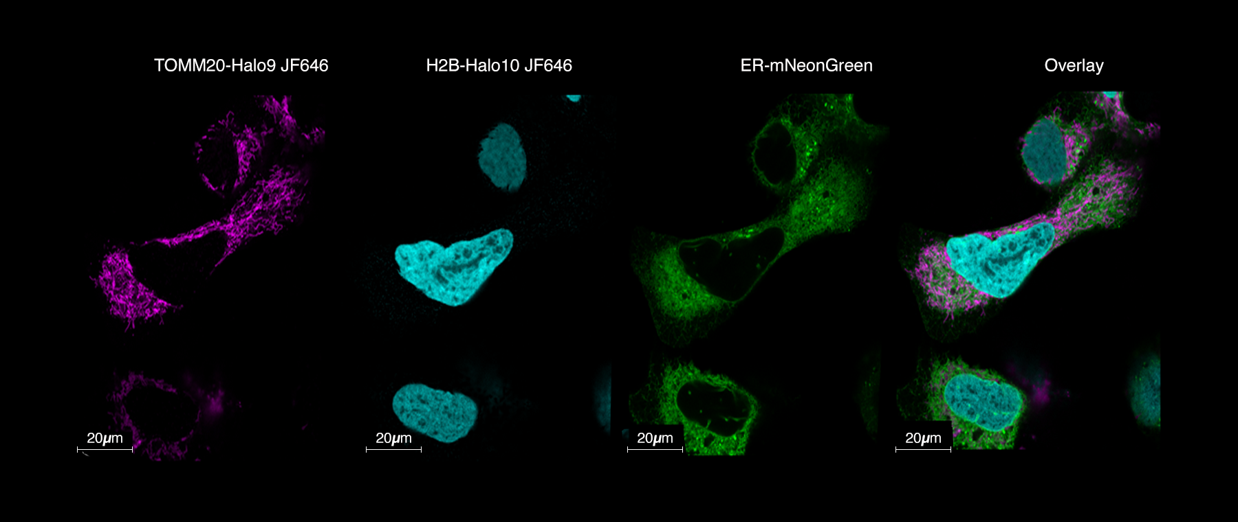 Live Cell Imaging of immortalized osteosarcoma cell line using the ...